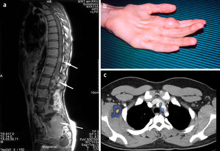 News on the genetics, epidemiology, medical care and translational ...