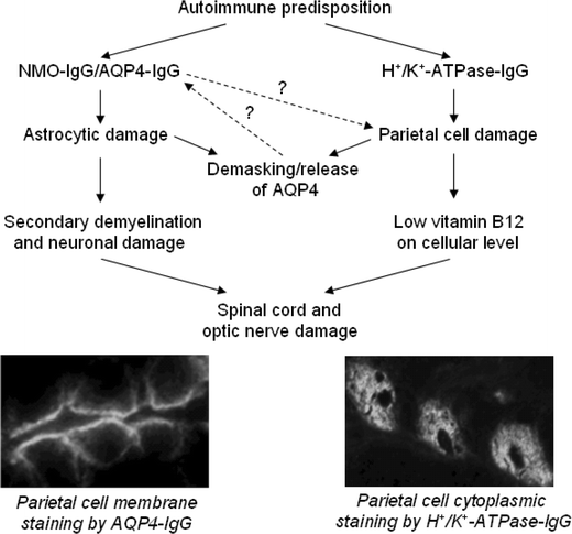 Low vitamin B12 levels and gastric parietal cell antibodies in patients ...