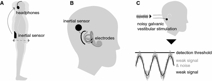 Noisy galvanic vestibular stimulation: an emerging treatment option for ...