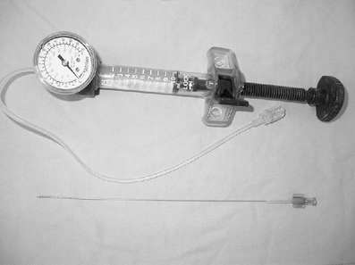 Balloon dacryocystoplasty and monocanalicular intubation with Monoka ...