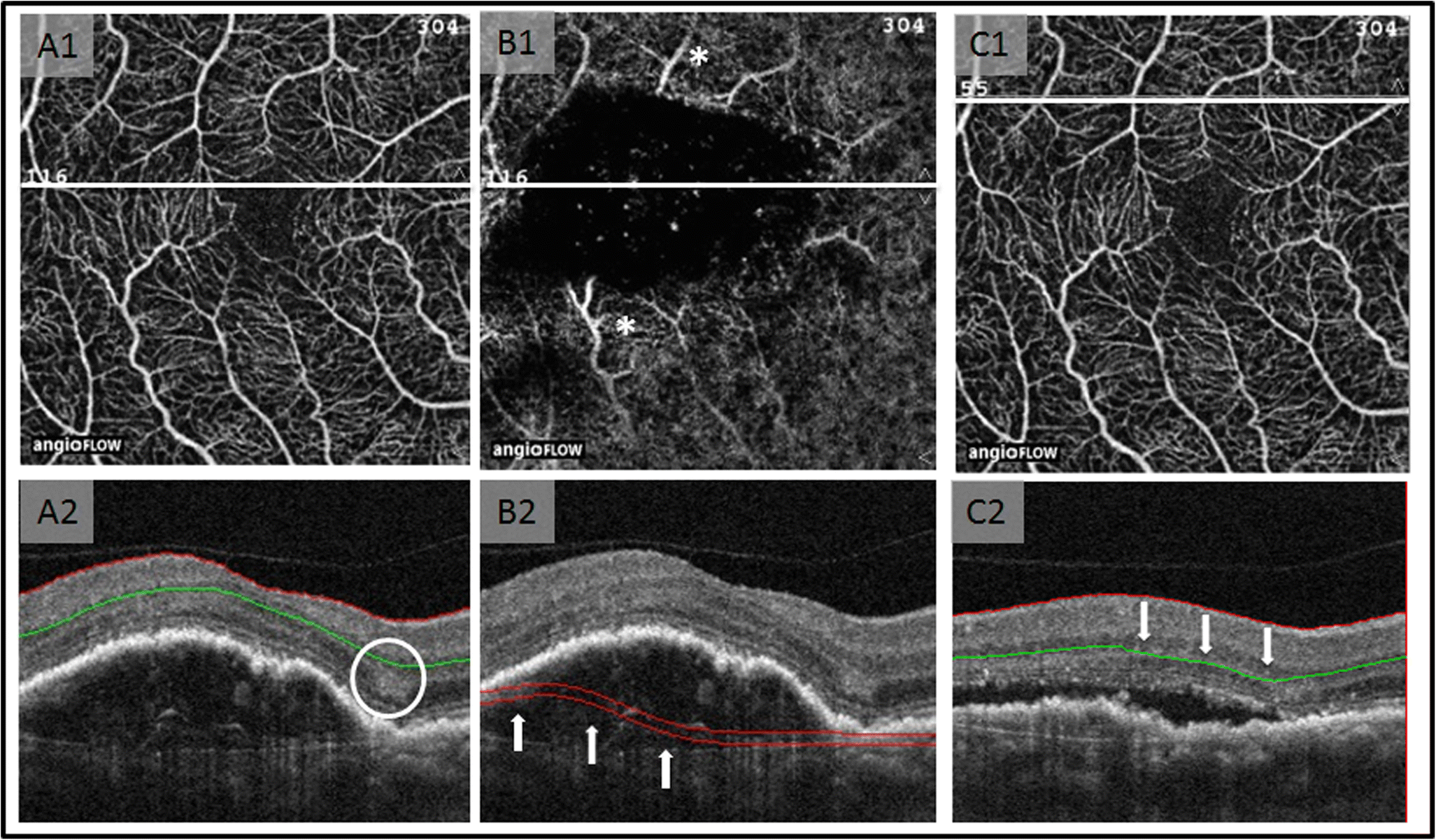 Prevalences of segmentation errors and motion artifacts in OCT ...