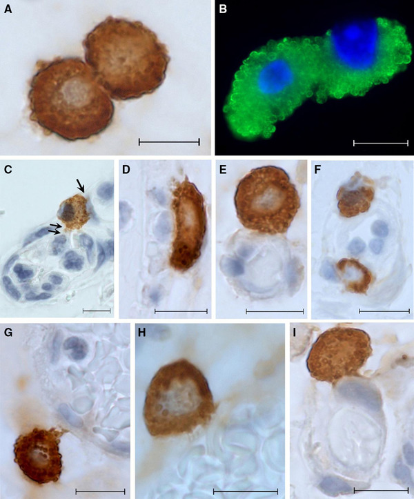 Tryptase as a polyfunctional component of mast cells | SpringerLink