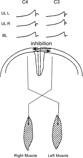 Bilateral deficit in maximal force production | SpringerLink