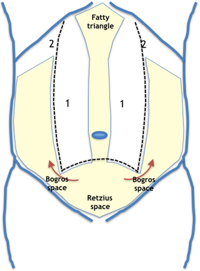 How we do it: down to up posterior components separation | SpringerLink