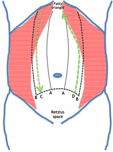 How we do it: down to up posterior components separation | SpringerLink
