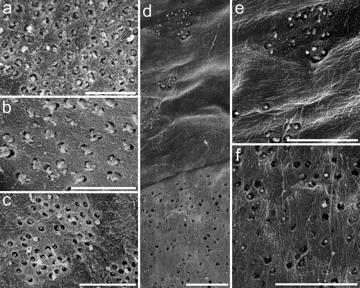 High resolution scanning electron microscopy of plasmodesmata ...