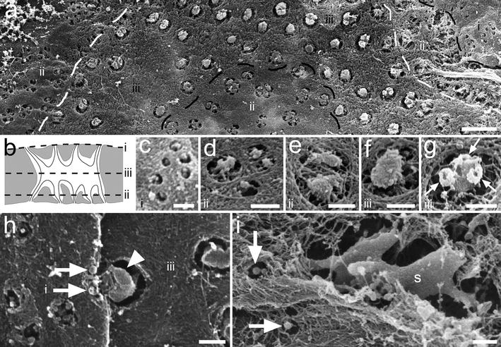 High resolution scanning electron microscopy of plasmodesmata ...