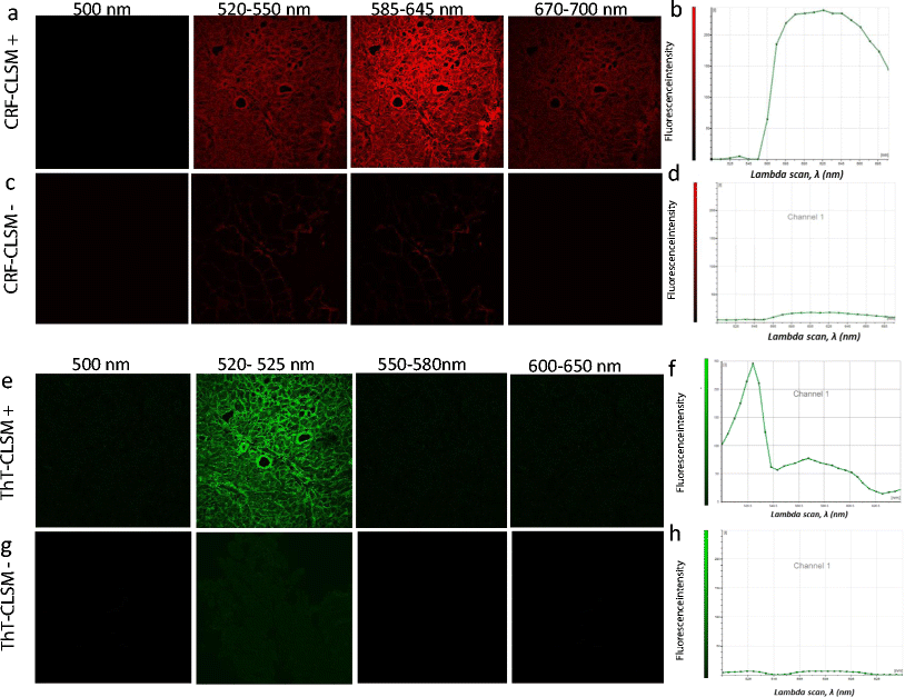 Application of confocal laser scanning microscopy for the diagnosis of ...