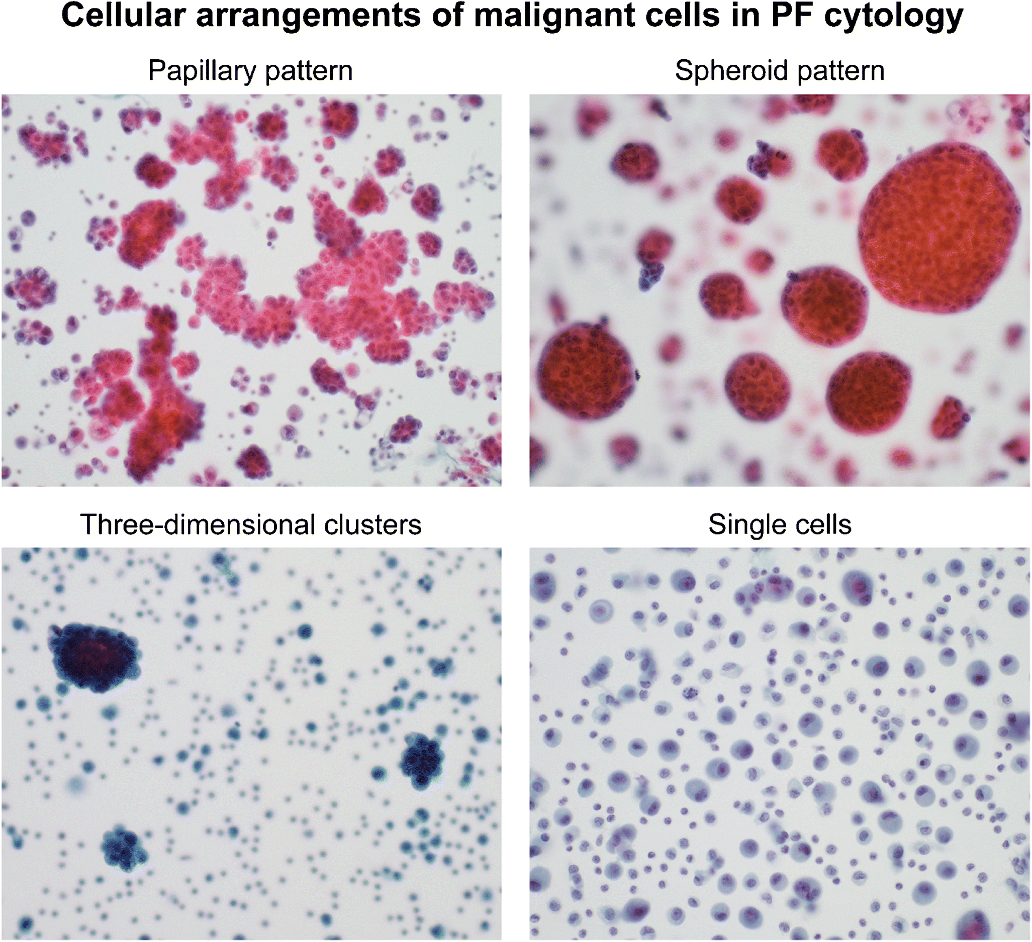 Comparative clinicopathological and cytomorphological analyses of ...