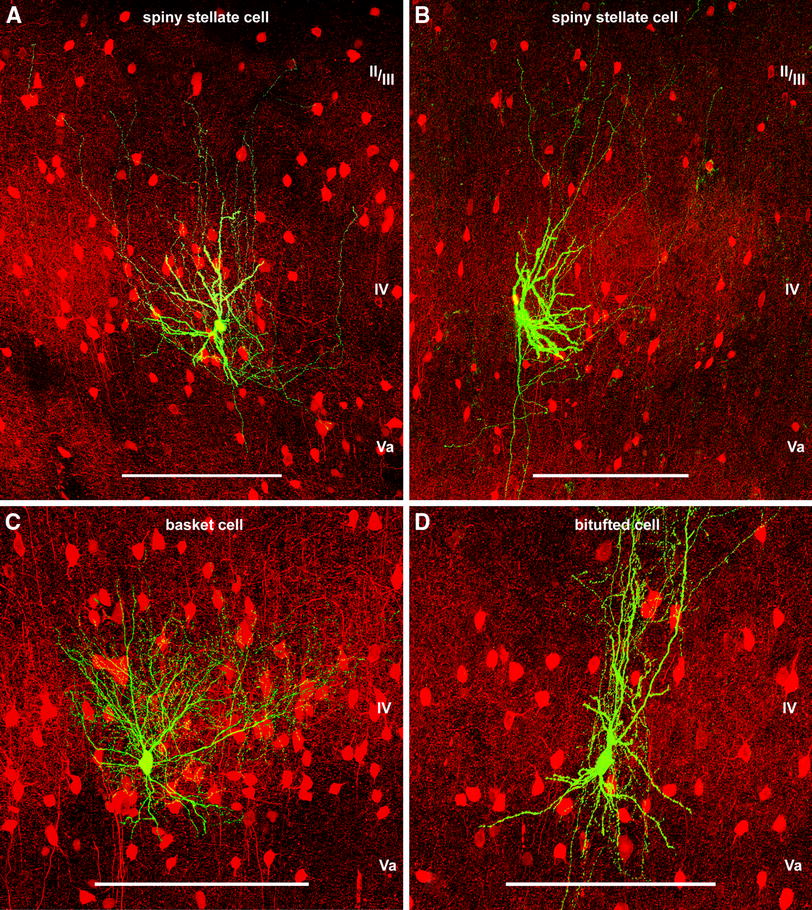 Local circuits targeting parvalbumin-containing interneurons in layer ...