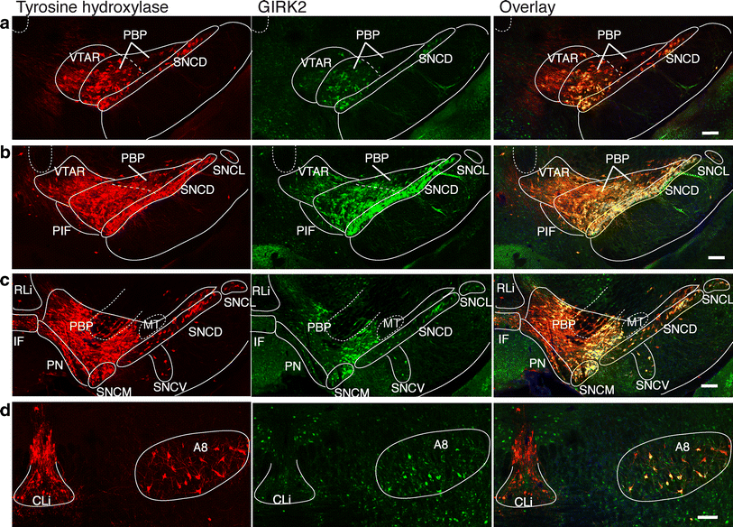 A cytoarchitectonic and chemoarchitectonic analysis of the dopamine ...