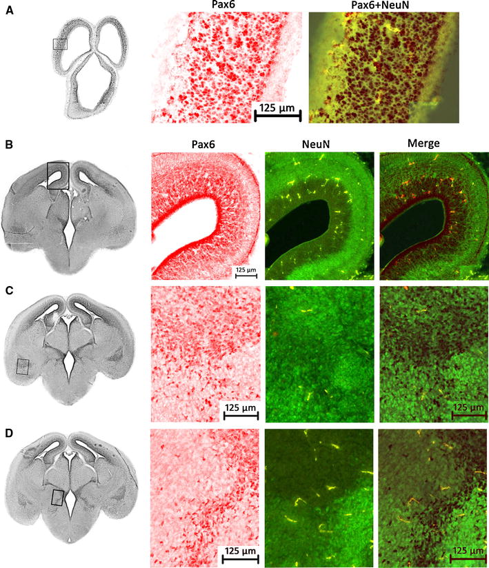 Spatiotemporal expression patterns of Pax6 in the brain of embryonic ...