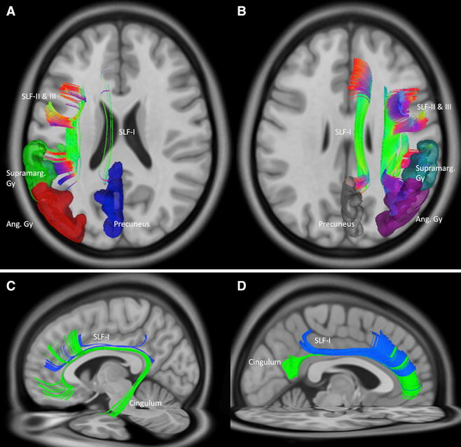 Subcomponents and connectivity of the superior longitudinal fasciculus ...