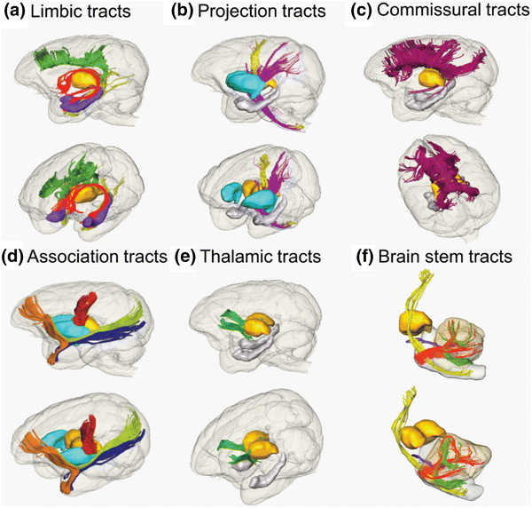 Population-averaged macaque brain atlas with high-resolution ex vivo ...