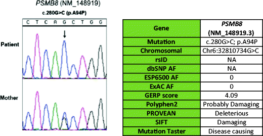 CANDLE syndrome: chronic atypical neutrophilic dermatosis with ...