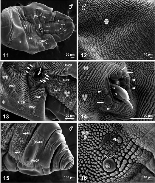 Ultrastructural characterization of male and female Physaloptera rara ...