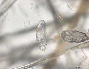 The first case of Demodex gatoi in Austria, detected with fecal ...