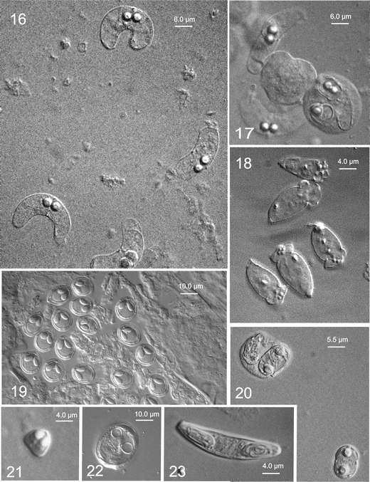 Study of Myxosporea (Myxozoa), infecting worldwide mullets with ...
