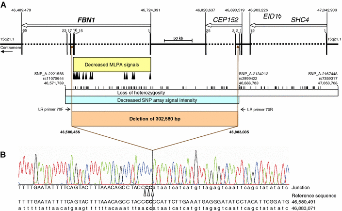 Large genomic fibrillin-1 ( FBN1) gene deletions provide evidence for ...