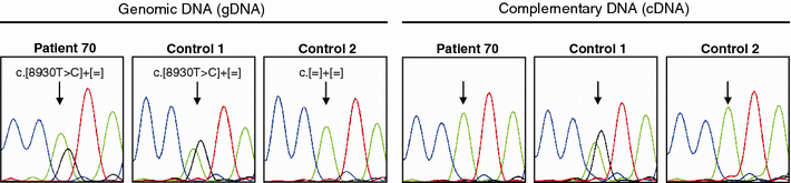 Large genomic fibrillin-1 ( FBN1) gene deletions provide evidence for ...
