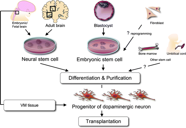 From bench to bed: the potential of stem cells for the treatment of Parkinson’s disease ...