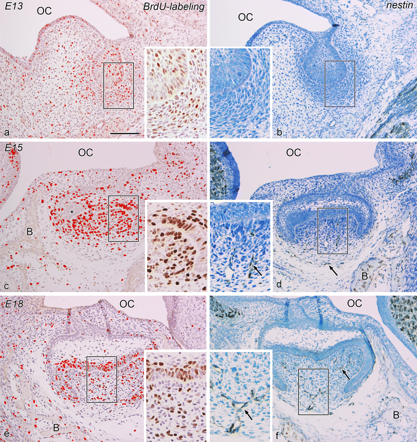 The relationship between cell proliferation and differentiation and ...