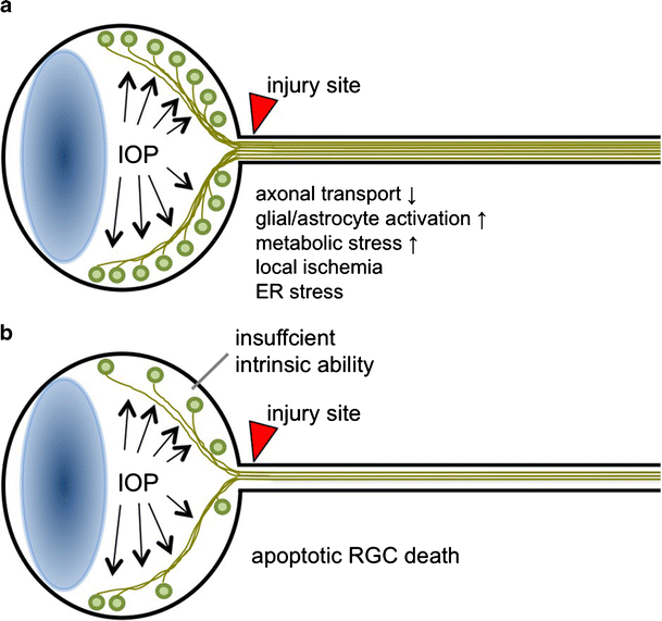 Glaucoma and optic nerve repair | SpringerLink