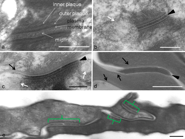 The biology and regulation of corneodesmosomes | SpringerLink