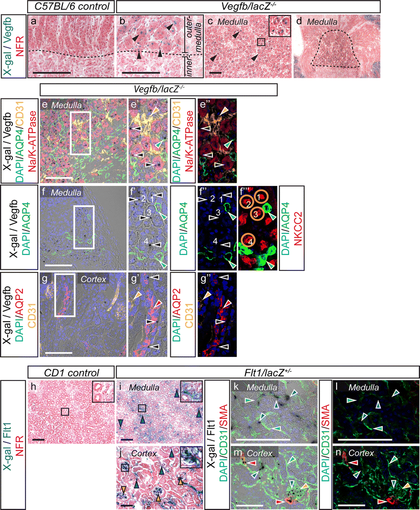 Expression of vascular endothelial growth factor (VEGF)-B and its ...
