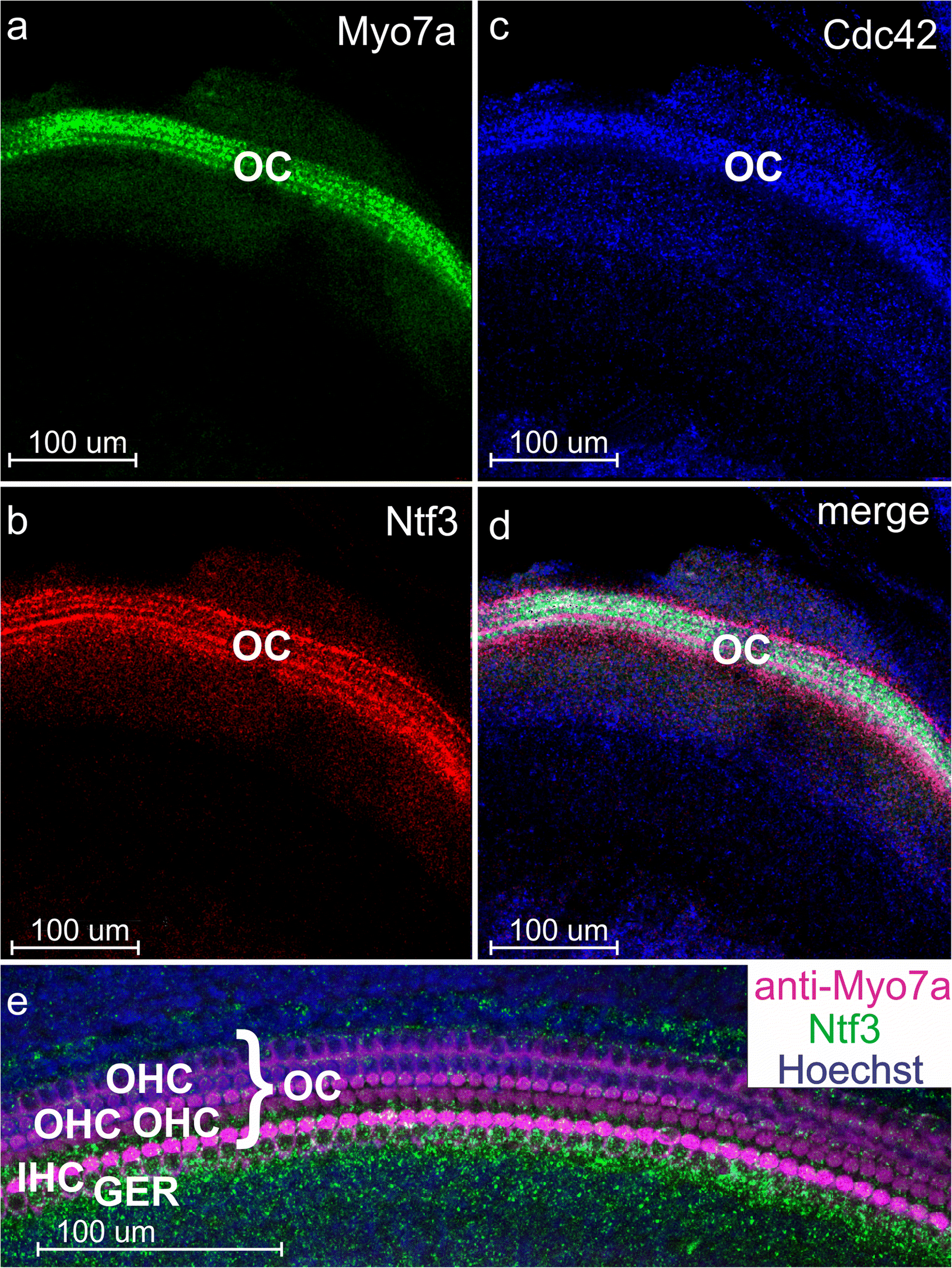 A RNAscope whole mount approach that can be combined with ...