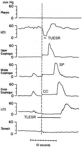 The Physiology of Eructation | SpringerLink