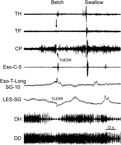 The Physiology of Eructation | SpringerLink