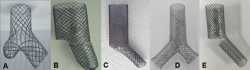 Customized airway stenting for bronchopleural fistula after pulmonary ...