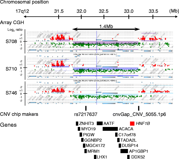 HNF1B alterations associated with congenital anomalies of the kidney ...