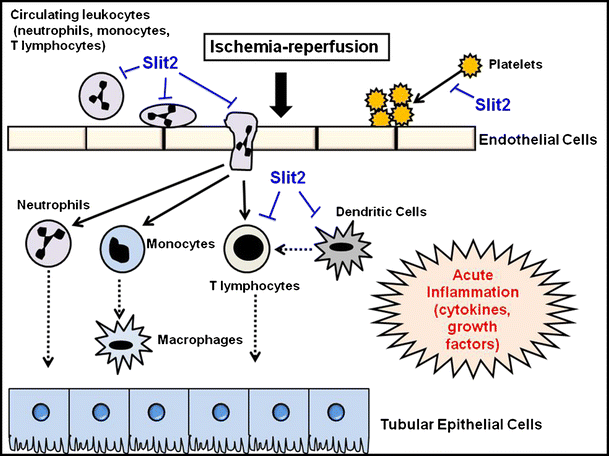 Slit2-Robo signaling in inflammation and kidney injury | SpringerLink