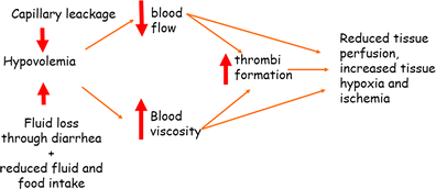 Hemoconcentration: a major risk factor for neurological involvement in ...