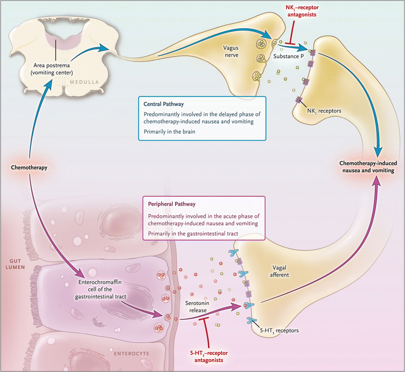 CINV: still troubling patients after all these years | SpringerLink