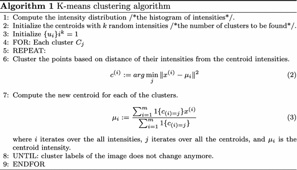 Adaptive k-means clustering algorithm for MR breast image segmentation | SpringerLink