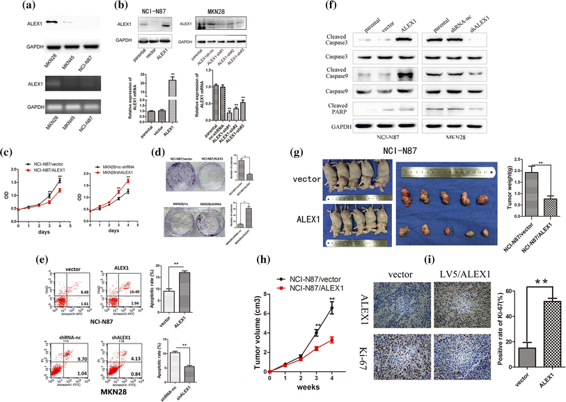 ALEX1, a novel tumor suppressor gene, inhibits gastric cancer ...