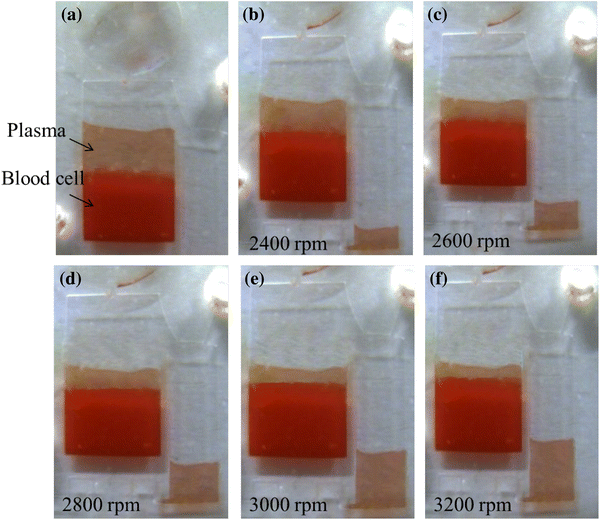 Decanting and mixing of supernatant human blood plasma on centrifugal ...