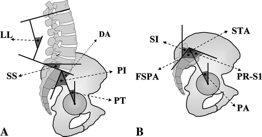 The femoro-sacral posterior angle: an anatomical sagittal pelvic ...