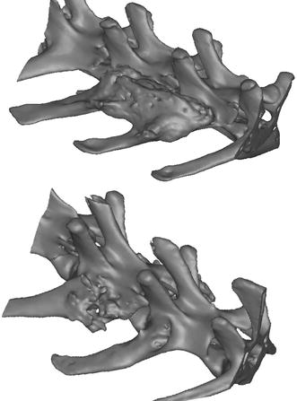 Posterolateral spinal fusion in a rabbit model using a collagen–mineral ...