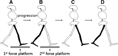 Asymmetrical gait in adolescents with idiopathic scoliosis | SpringerLink