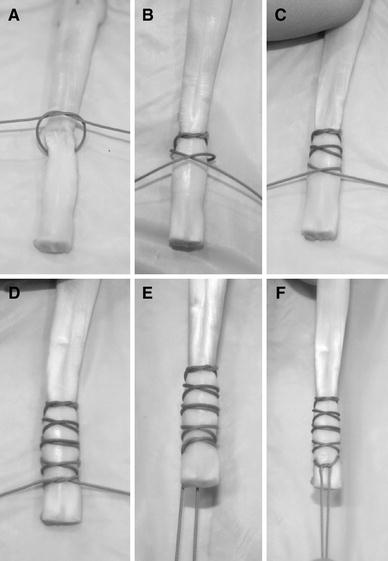 Whip stitch versus grasping suture for tendon autograft | SpringerLink