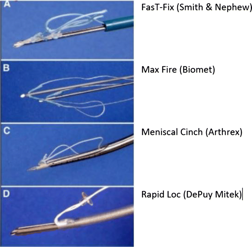 Current concepts in the techniques, indications and outcomes of ...