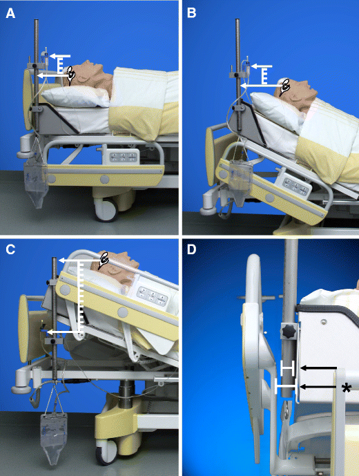 Mounting device for external cerebrospinal fluid drainage: the Freiburg ...