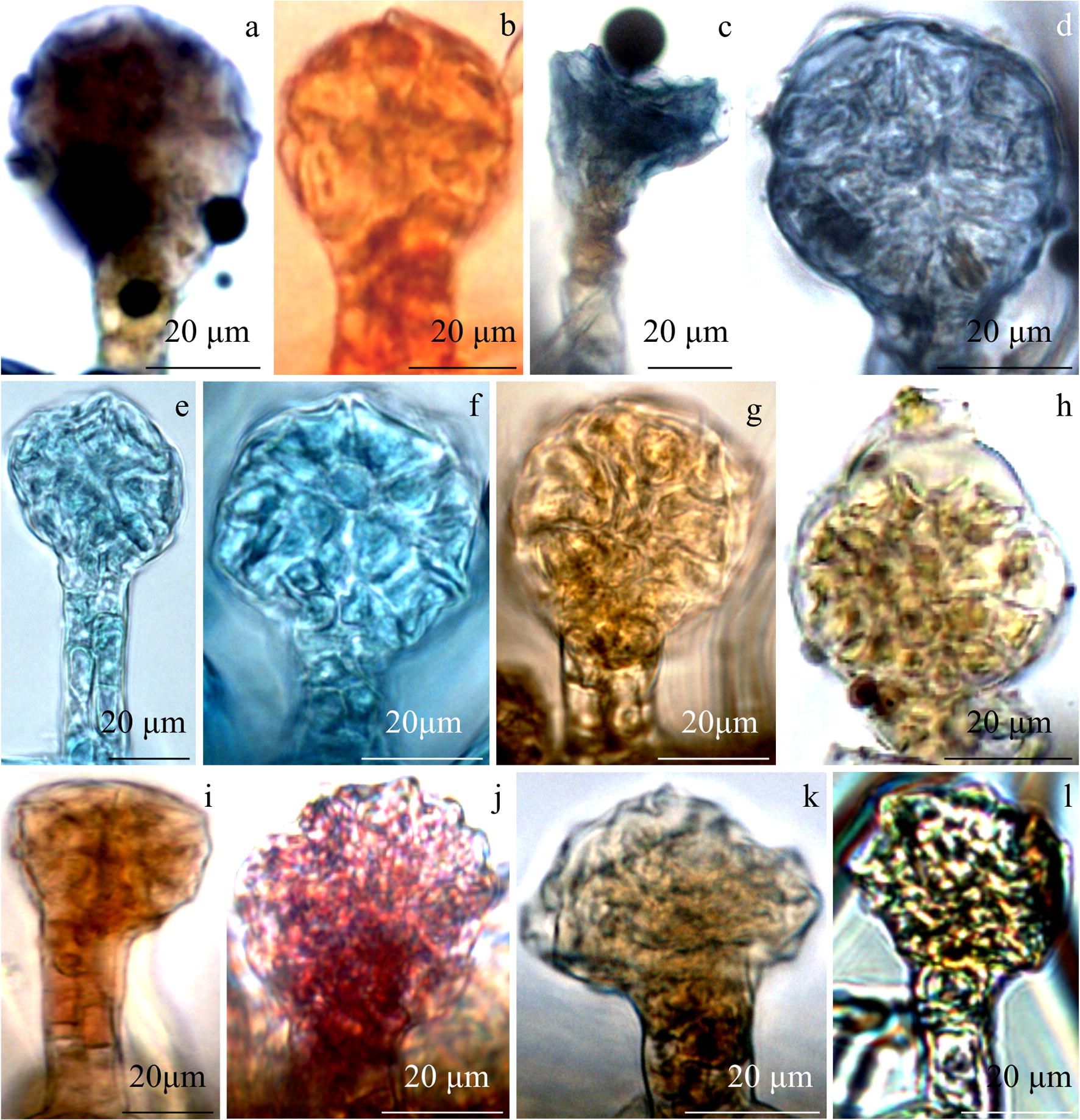 Histochemical assays of secretory trichomes and the structure and ...