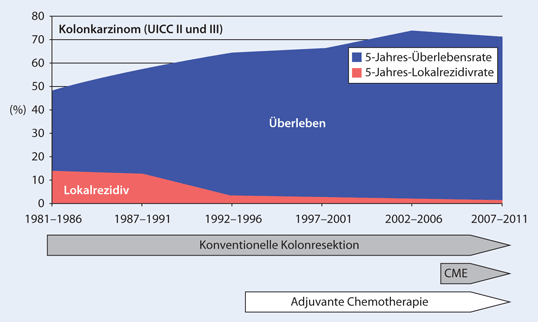 Chirurgische Therapie des Kolonkarzinoms | SpringerLink