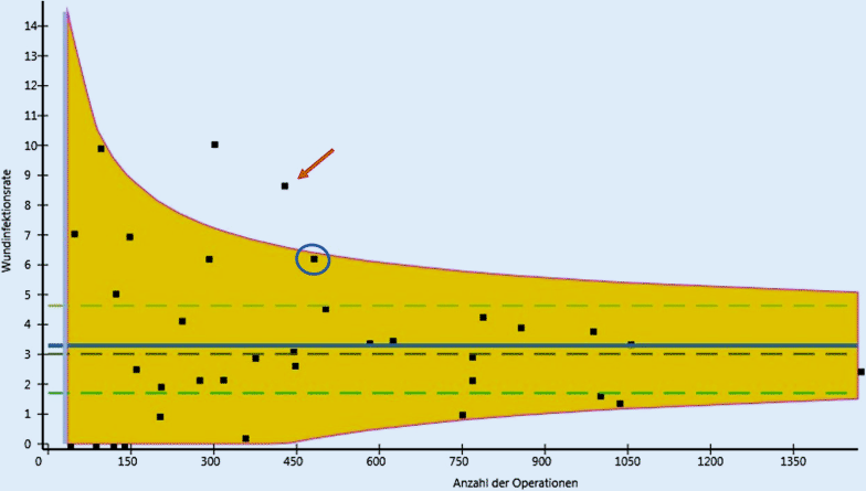 Postoperative Wundinfektionen in der Gefäßchirurgie – Wo stehen wir? | SpringerLink