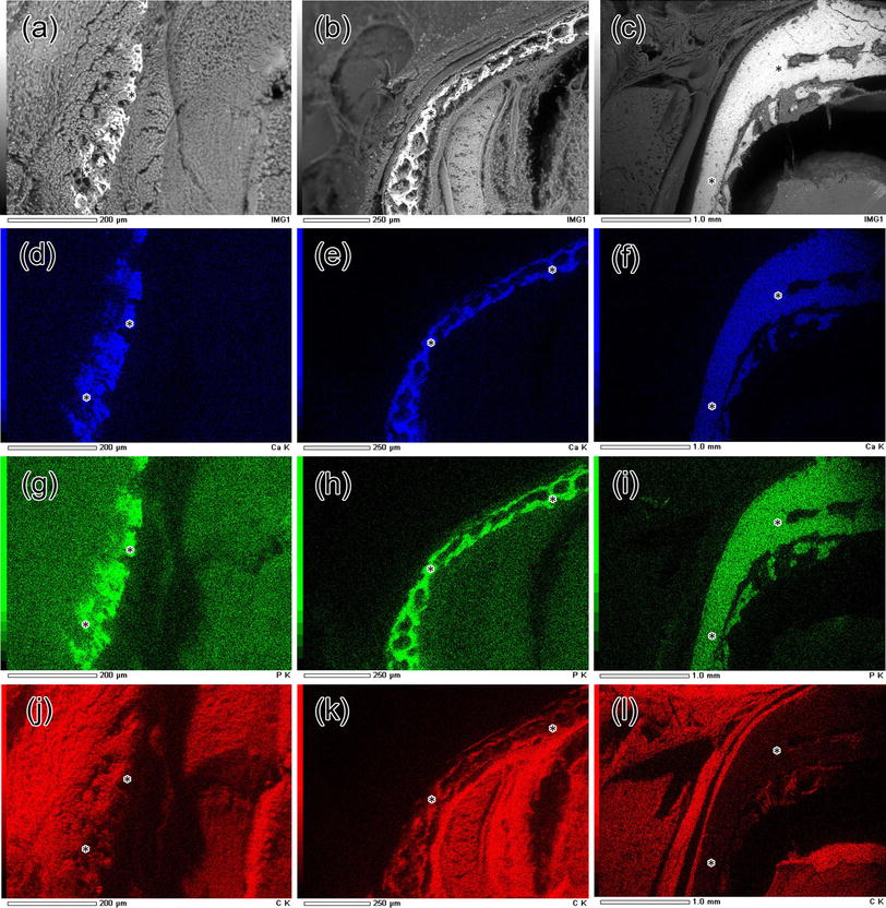 Bone matrix calcification during embryonic and postembryonic rat ...
